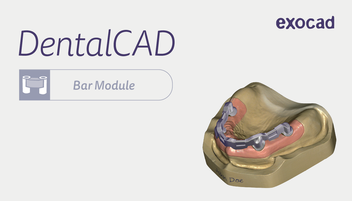 Module barre Exocad DentalCAD – DAOS DENTAL SAS