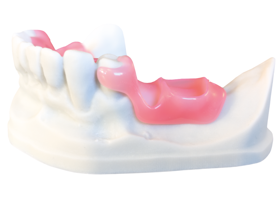 Résine Optiprint Interim Dentona – DAOS DENTAL SAS